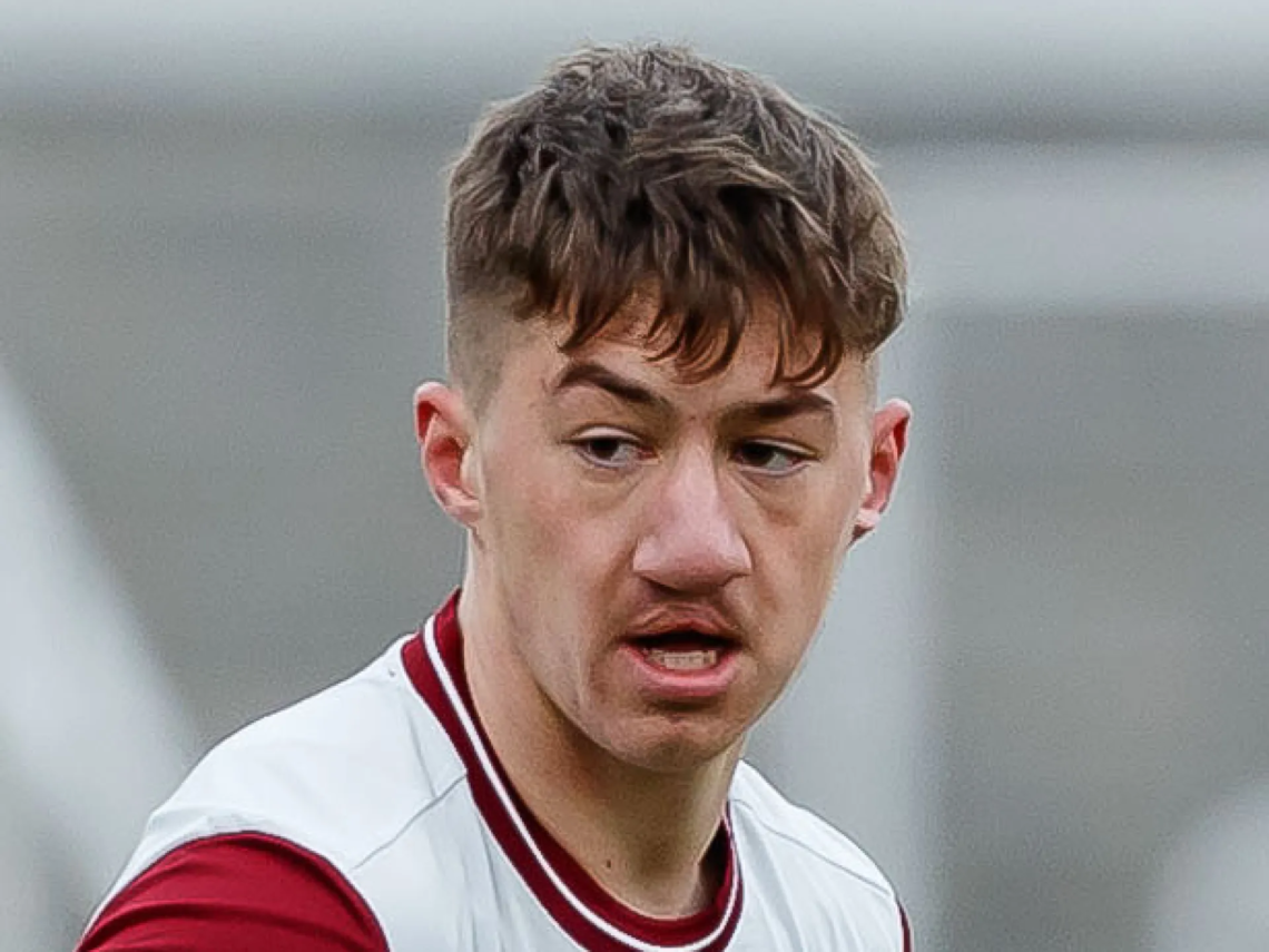 Angelo Stiller Hasenscharte Die Geschichte hinter dem Fußballprofi